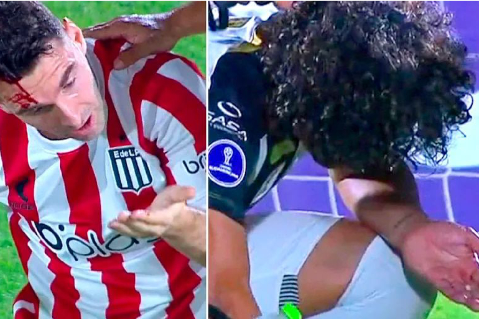 Mauro Boselli termina ensangrentado por un impactante cabezazo; jugador ...